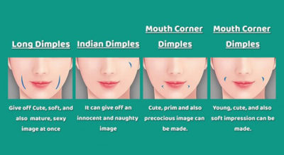 Dimple Creation Surgery in Delhi | Dimple Surgery Cost - Dr Rajat Gupta