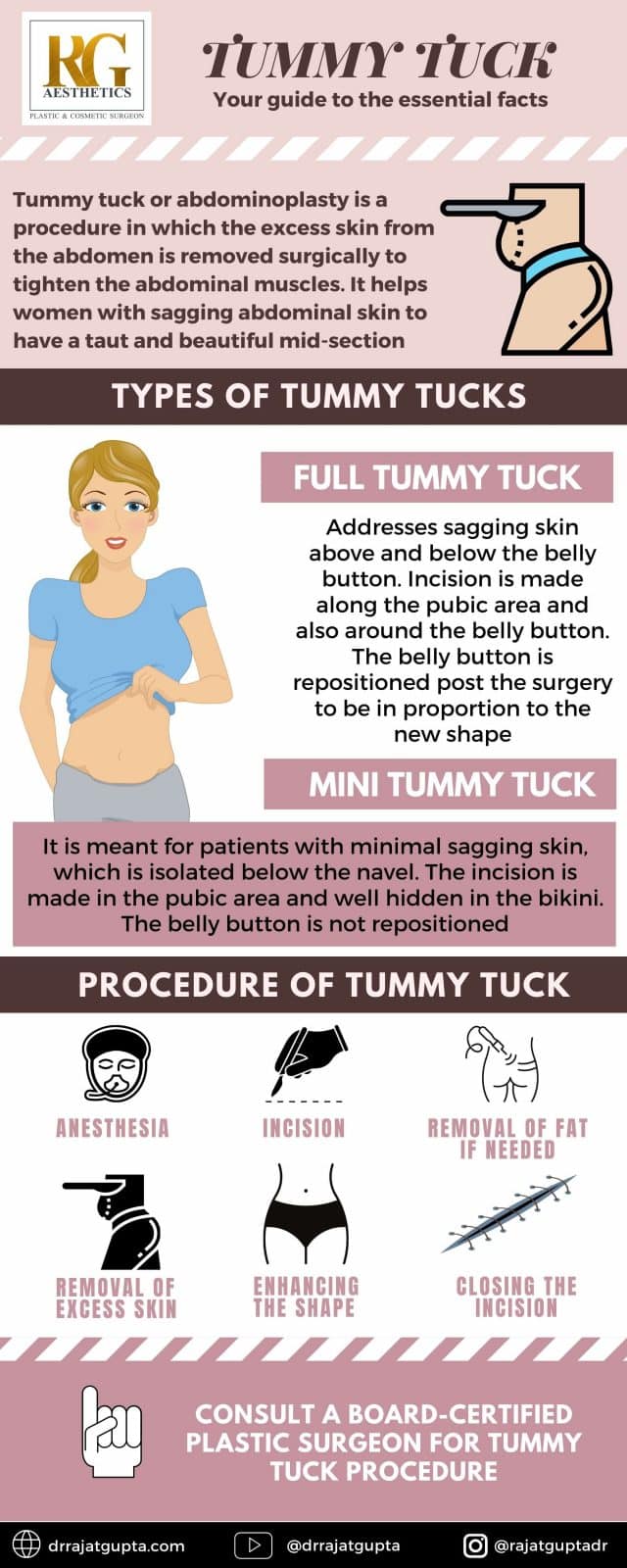 Tummy Tucks or Abdominoplasty The Complete Overview - Dr Rajat Gupta