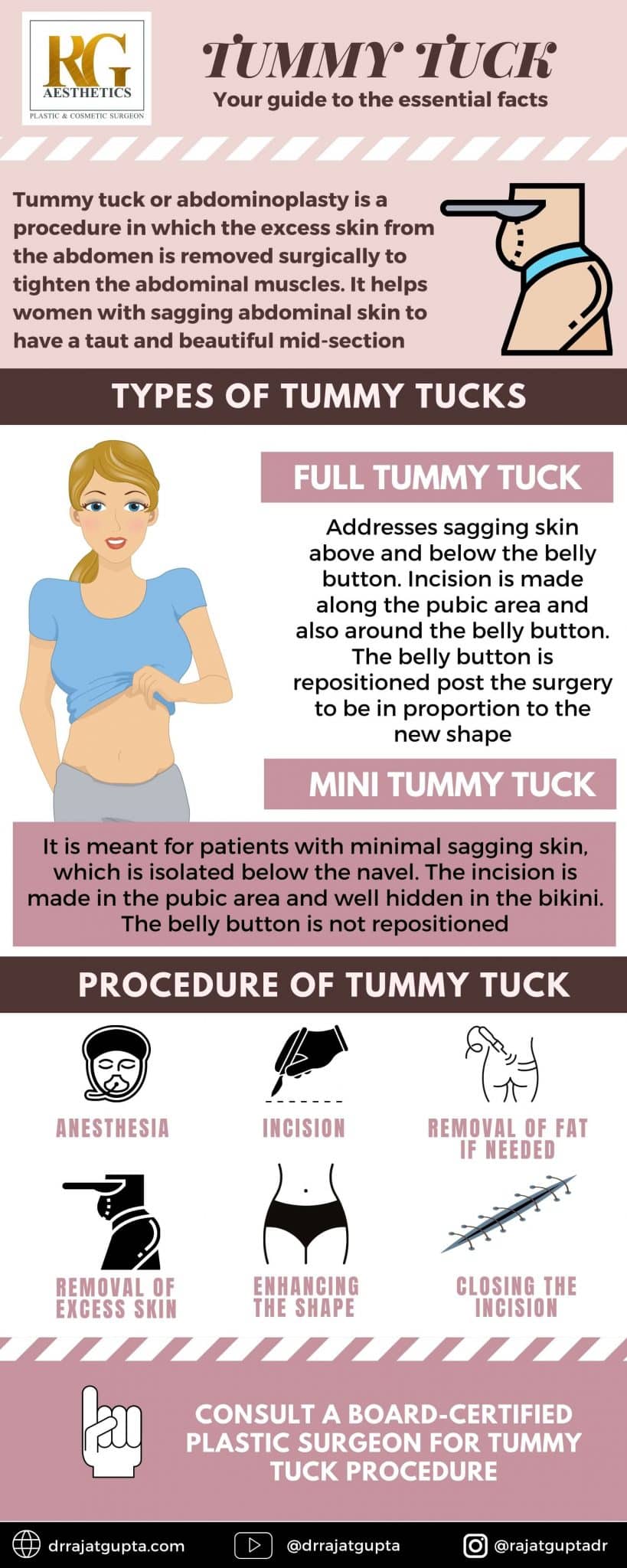 Mini Tummy Tuck Recovery Timeline Sealukraine