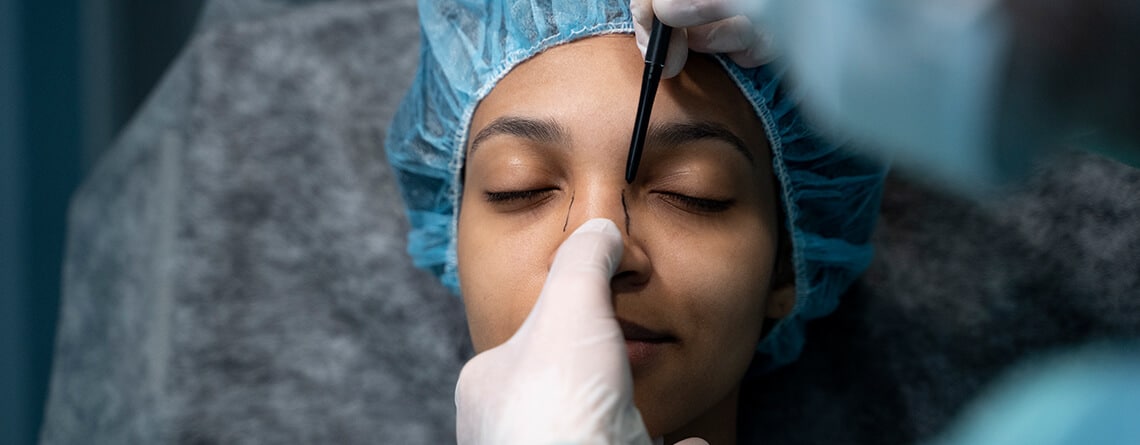 Can Rhinoplasty Correct a Nasal Hump and Crooked Bridge?
